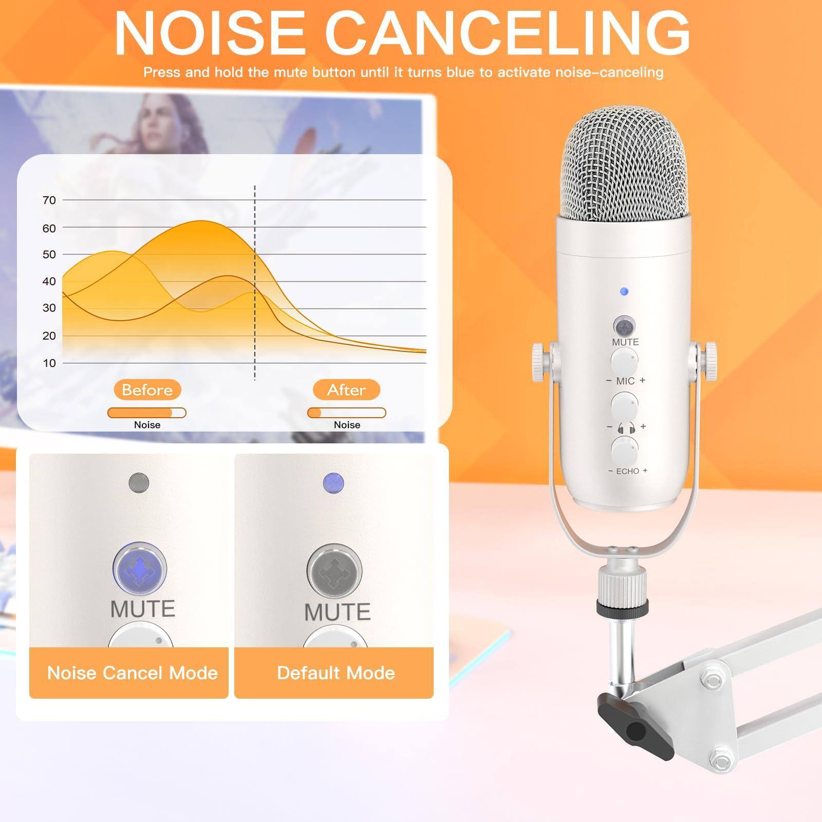 Dazzling Pops Gaming Microphone Kit Podcast Condenser Usb Mic With Boom ...