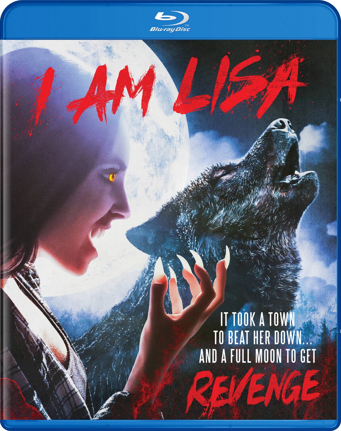 I Am Lisa BLU RAY - Best Buy