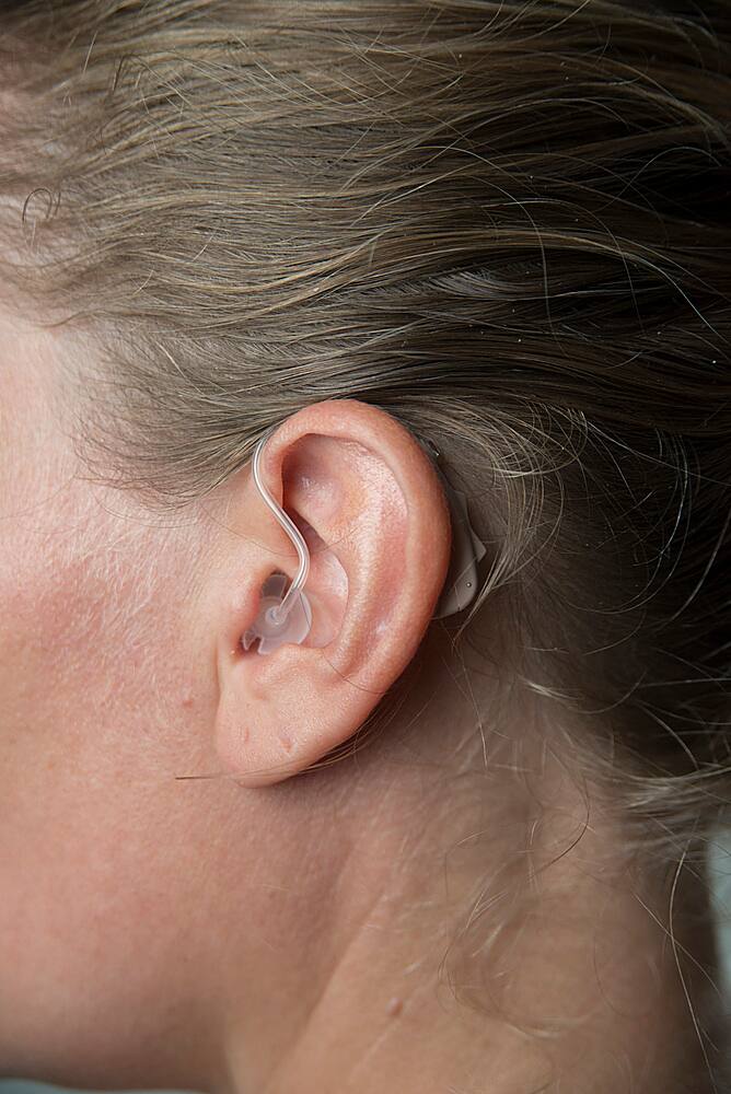 Customer Reviews: Hearing Assist EAZE OTC Hearing Aid Kit, BTE ...