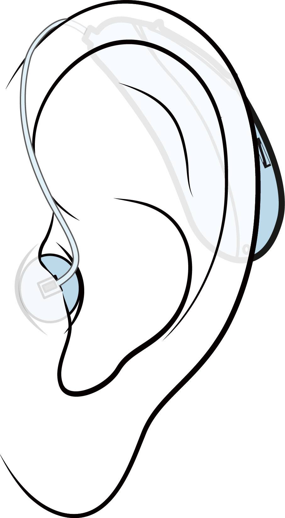 Customer Reviews: Sennheiser All-Day Clear OTC Self-Fitting Hearing Aid ...