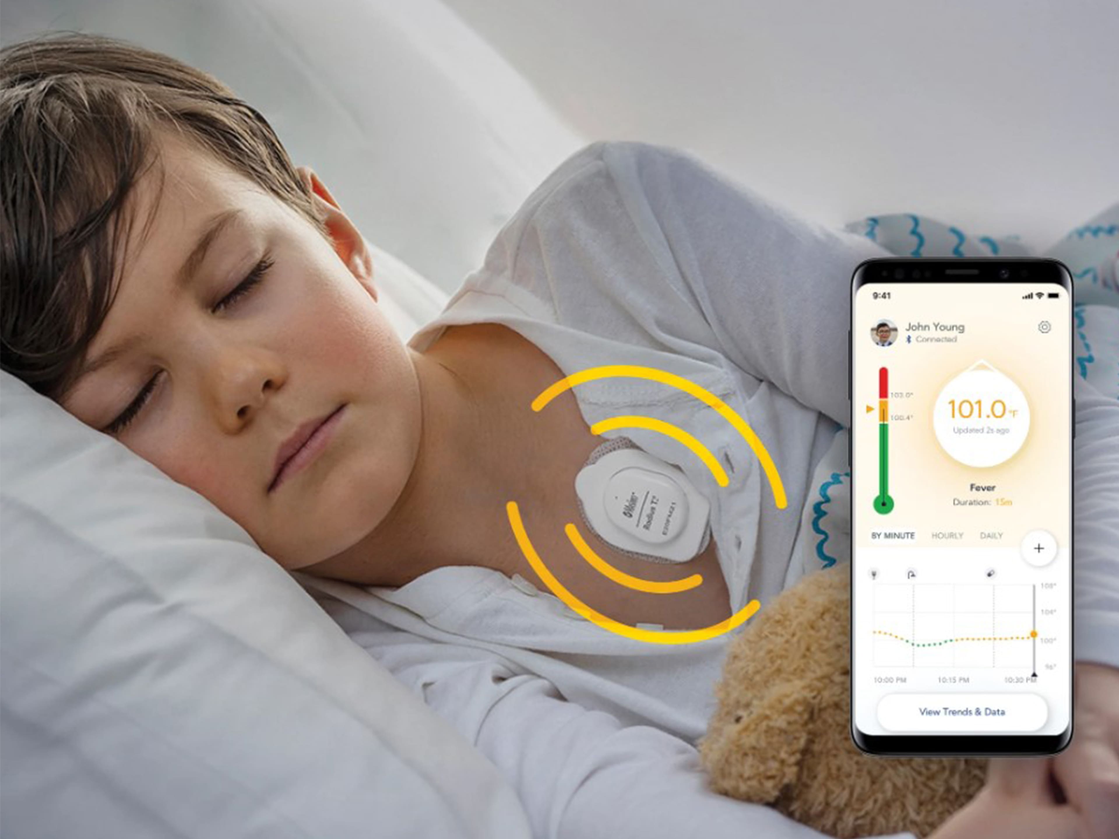 Best Buy: Masimo Radius T Digital Smart Wearable Thermometer White 4823